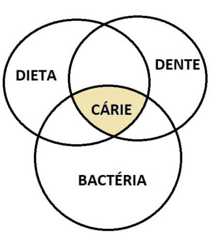 Cariologia - Entenda como funciona a cárie dental